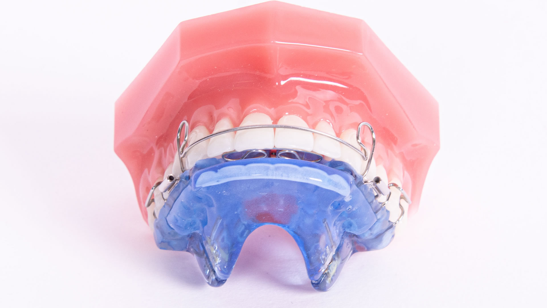 FAQ antwoord op al je vragen - beugel