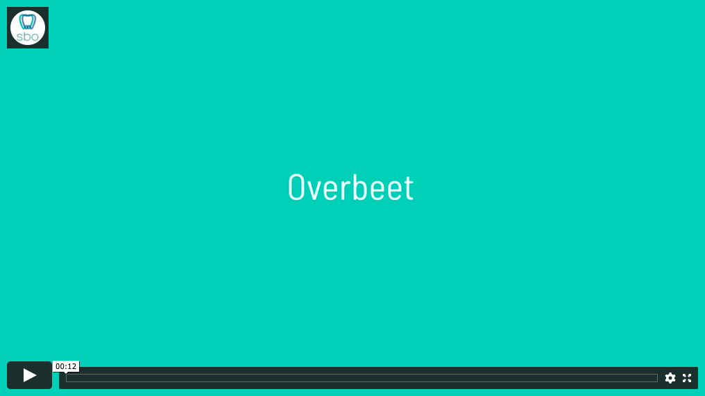 Een beugel nodig? Waarom - beugel